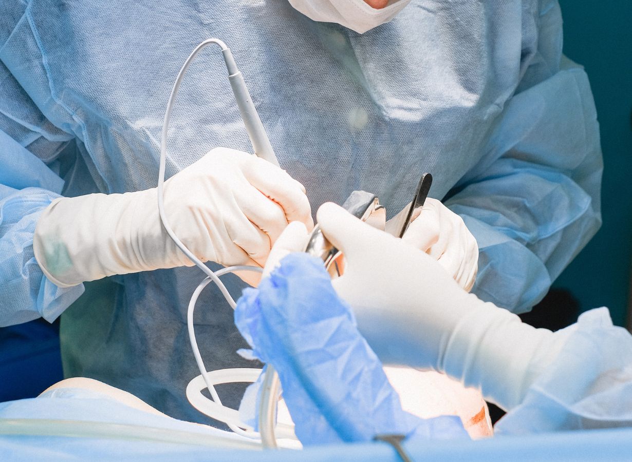 Turbinoplastia (cirurgia dos cornetos nasais) - Clínica ORL